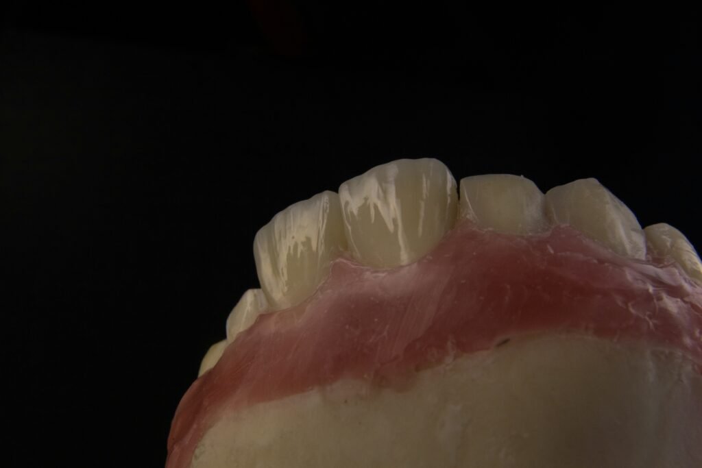 Emax bridge vs zirconia bridge: Which One for Front Teeth?